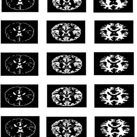 Mr Brain Tissues Segmentation Using The Existing And Proposed Method Download Scientific