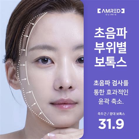 메타뷰and초음파진단부위별 보톡스 할인 가격 후기 전후 효과 정보 By 엠레드의원 여신티켓 국내 1등 피부과 성형