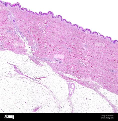 Sweat Duct In Skin Light Micrograph Of A Section Thro