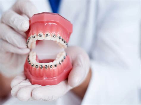 How Much Do Braces Cost At Riverwalk Dental And Orthodontics