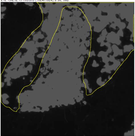 Area Fraction In ImageJ Image Analysis Image Sc Forum