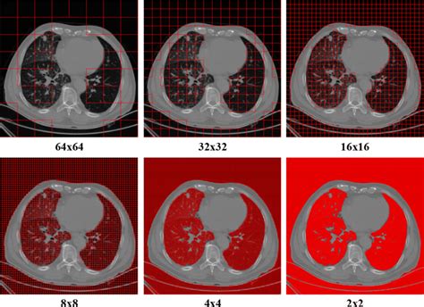 Segmentations Using K Means Clustering With Different Patch Sizes