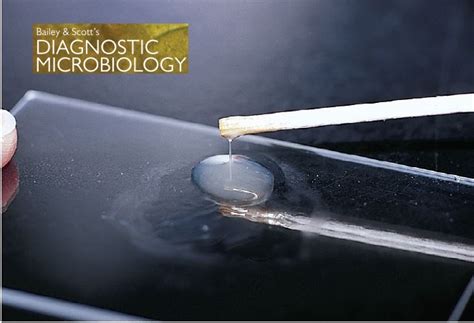 تست استرینگ String برای گونه های ویبریو آزمایشگاه مجازی میکروب شناسی