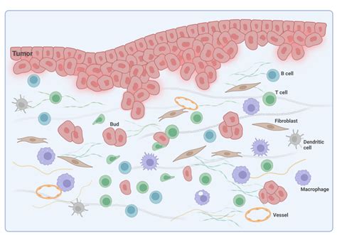 Deepening Understanding Of Tumor Budding In Colorectal Cancer For Effective Immunotherapy