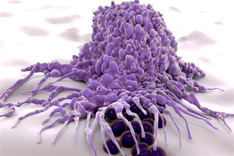 がん細胞は「死んだ仲間」が免疫細胞に食べられると増殖する ナゾロジー