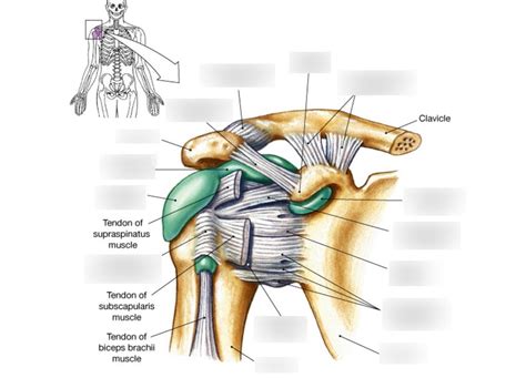 Subcoracoid Bursitis