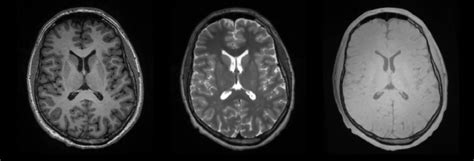 8 axial slice acquired with t1 t2 and pd weighted mr imaging