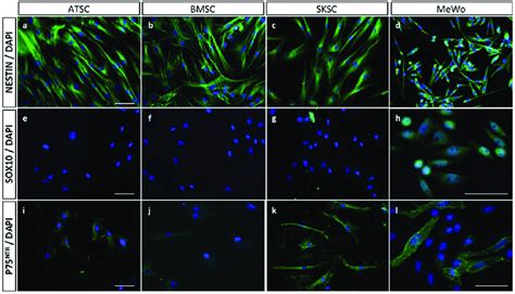 Mouse Ncsc Related Characteristics In Human Cells Similarly To