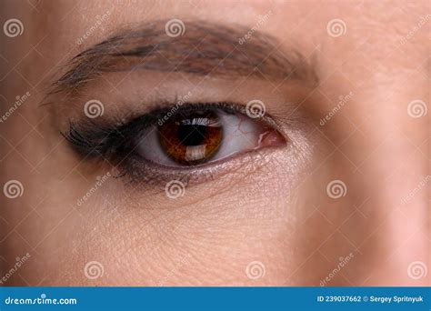 Disease Of Retina Of The Eye Close Up Of Female Eye With Red Inflamed