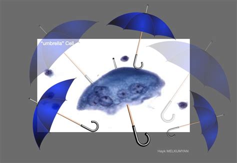 A Term For A Multinucleated Superficial Cell Of The Bladders