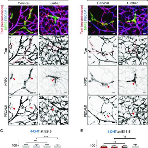 Temporally Restricted Lineage Tracing Of Bec Derived Lymphatic