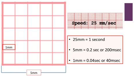 10 Ecg Interpret Topic 10pptx 10 Ecg Interpret Topic 10pptx