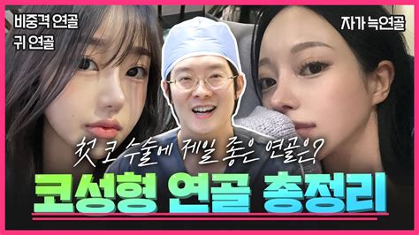 코 수술 연골 뭐가 좋을까 완벽 분석 기증 자가늑연골 비중격연골 귀연골 Youtube