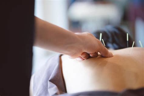 Acupuncture Could Help Boost Sex Drive Experts Say
