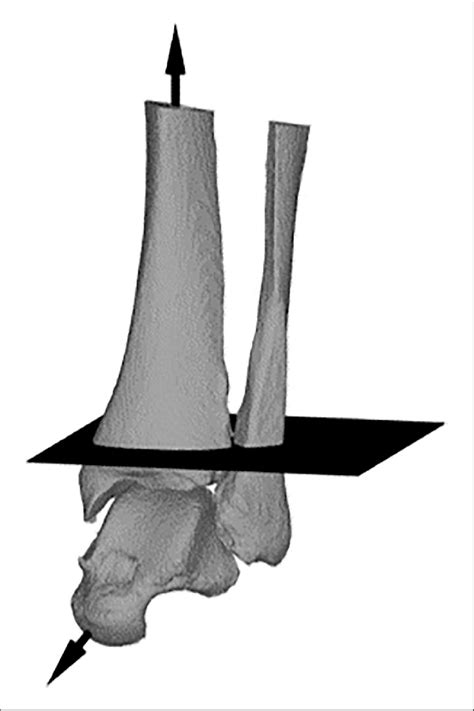 Long Axis Of The Tibia And Talar Axis Plane Slices Through The Download Scientific Diagram