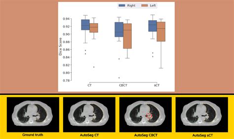 9 First Row Shows Box Plot Showing Dice Scores For Segmentation Of The
