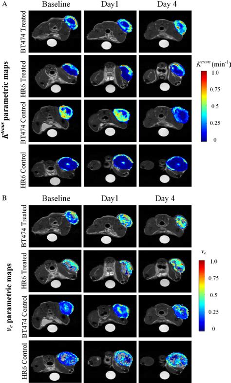 Dce Mri Parametric Maps A K Trans And B V E Of A Representative Download Scientific