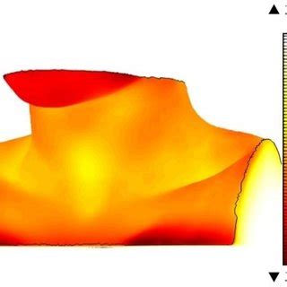 Temperature Distribution On The Patient Specific Human Neck Units Are Download Scientific