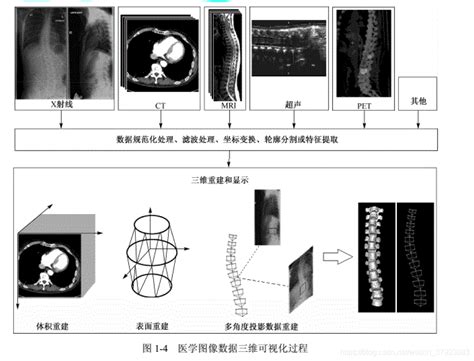 医学图像三维重建与可视化笔记2——医学图像三维可视化系统的组成医学图像三维可视化的过程 Csdn博客