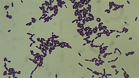 Enterococcus Avium Introduction Morphology Pathogenicity Lab