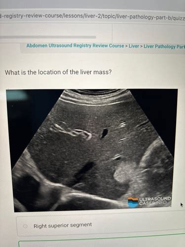 Liver Pathology Quiz Flashcards Quizlet