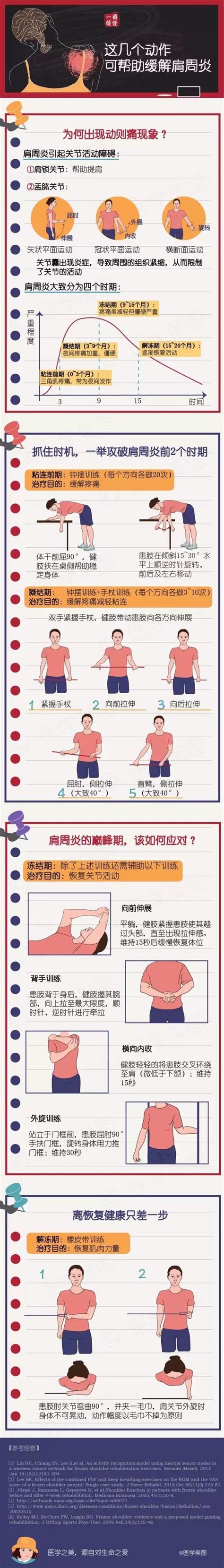 一图读懂丨这几个动作可帮助缓解肩周炎 医学界 助力医生临床决策和职业成长