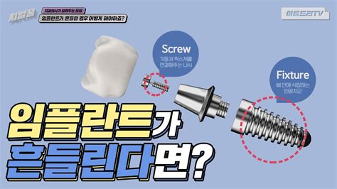 임플란트가 흔들려요 흔들림 어쩌죠 치과의사가 알려주는 꿀팁 강남 아름드리치과 Youtube