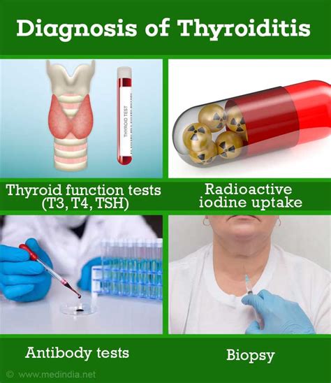 Thyroiditis Thyroiditis Types Causes Symptoms Diagnosis Treatment The Best Porn Website