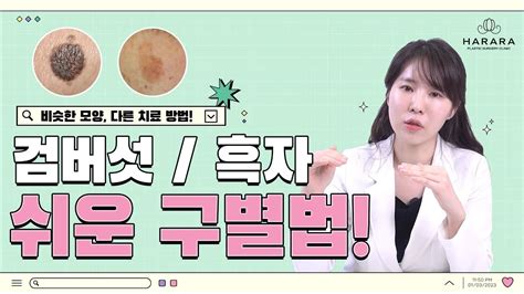 부산 하단 검버섯 흑자 구별법은 Youtube