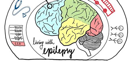 Diya Asawa On Linkedin Hyperactive Neural Networks Exploring Epilepsy