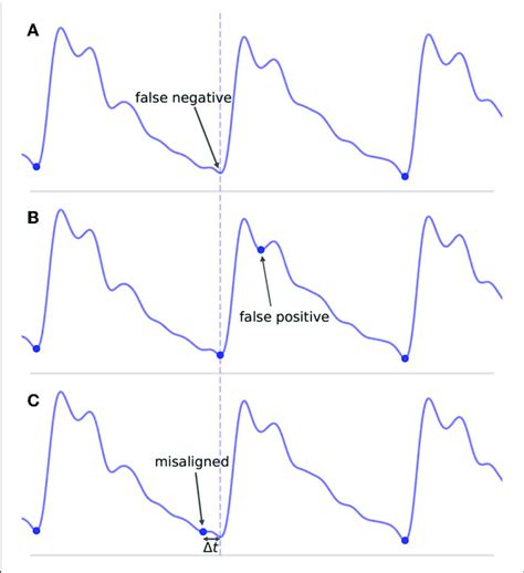 Shown Are The Different Types Of Classification Errors These Are Download Scientific Diagram
