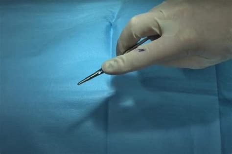Surgery Injection Alternative To Surgery For 24 Year Old Youth Facing Issues In Urinating