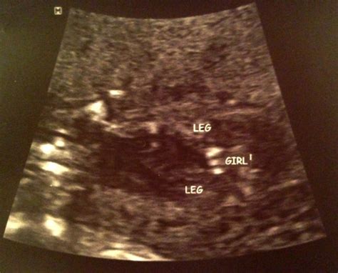 Conceiving Piper Let S Talk About Sex Baby