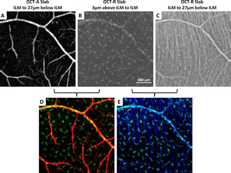 Simultaneous Imaging Of A Superficial Retinal Vascular Network B Download Scientific