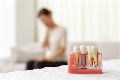 임플란트 종류 임플란트 가격 임플란트에 대한 모든 것 닥터나우