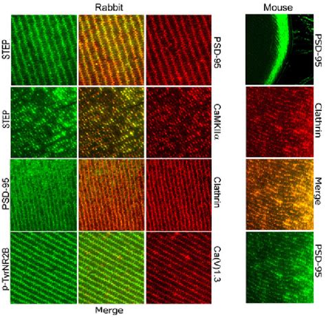 In Situ Indirect Immunofluorescence Detects Psd 95 In About 4 Month Old