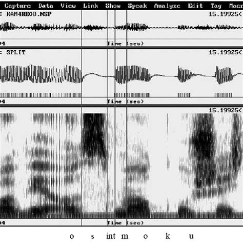 Oscillogram Electroglottogram And Spectrogram Of The Sequence O