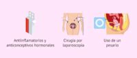 ¿qué Es El útero Retroverso Causas Y Síntomas