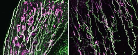 Mysterious Structures Appear To Play Unique Role In Sexual Pleasure Sciencealert