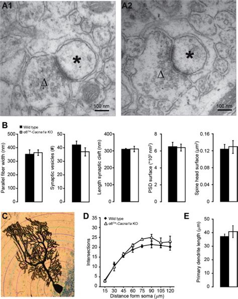 Ultrastructure Of Granule Cell Axon Terminals And Purkinje Cell Spines