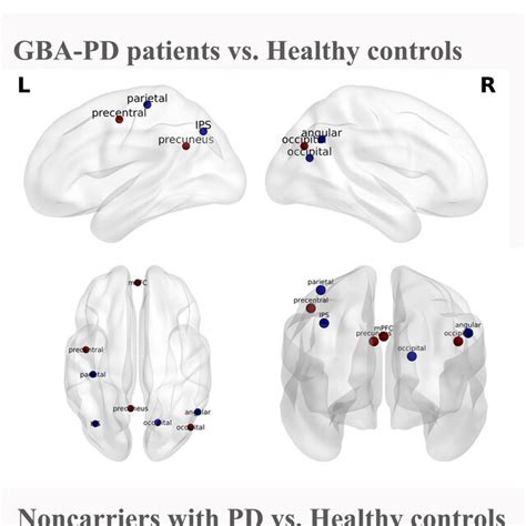 The Differences In Nodal Betweenness Centrality Of The Functional