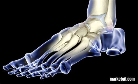 Is Accessory Navicular Bone Dangerous Marketgit