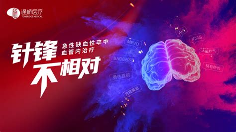 急性缺血性卒中血管内治疗 “针锋”不相对 如水万变，至柔至刚 —— 神介女医生奋斗之路 脑医汇 神外资讯 神介资讯