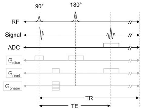 Pulse Sequence Diagram A Pulse Se Quence Diagram Can Be