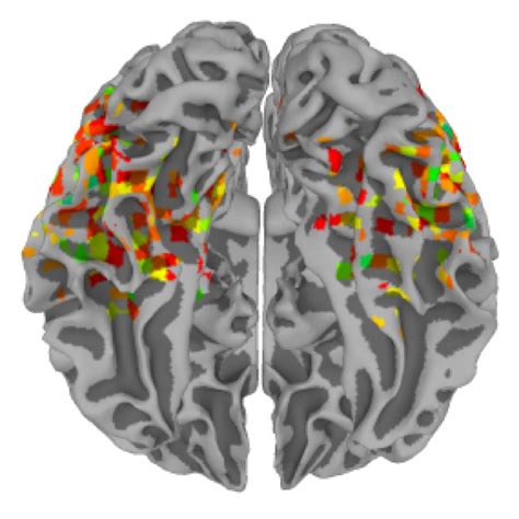 Deep Representational Similarity Learning For Analyzing Neural