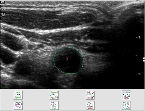 Figure B 8 The Spline Tool The Various Buttons Below The Image Allow Download Scientific