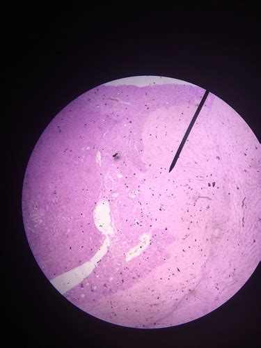 Endocrine Flashcards Quizlet