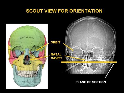 Head And Neck Block 2 Ct Series Xrays