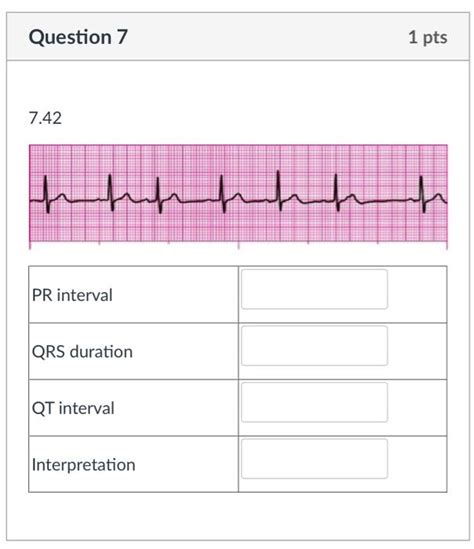 Solved Question 7 1 Pts 7 42 Pr Interval Qrs Duration Qt
