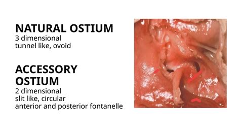 Anatomy And Development Of Paranasal Sinuses 2pptx